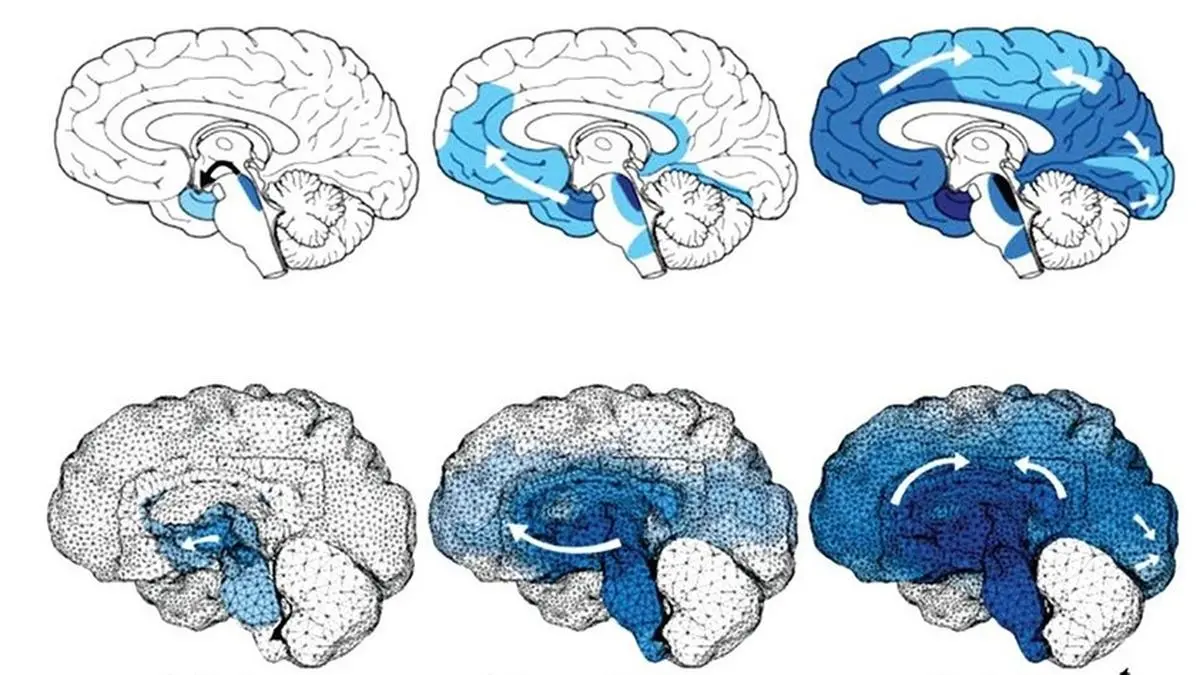 A physical model for neurodegenerative diseases - Frontline