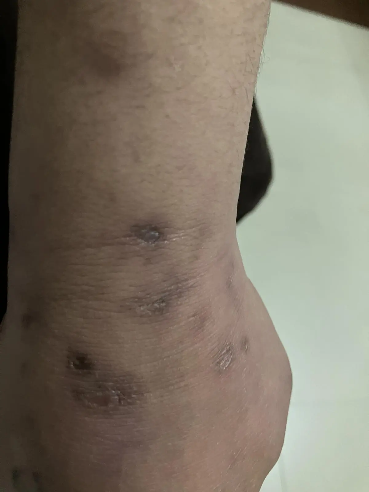 For Kashmiri women, drugs offer an escape route from anxiety ...