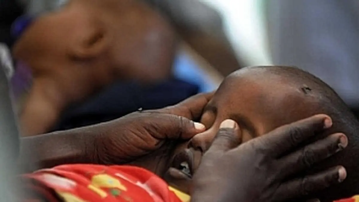 Starving nation - Frontline