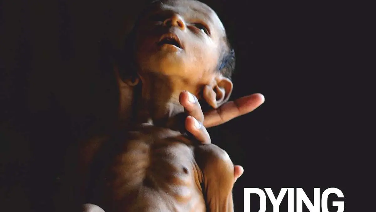 Dying Young - Frontline