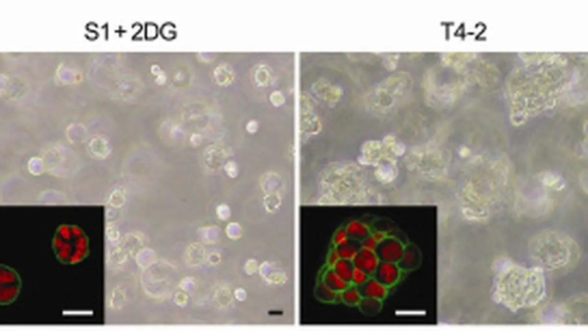 Sugar uptake & breast cancer - Frontline