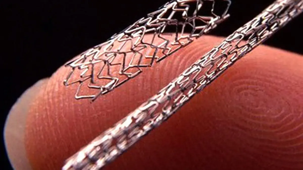 For affordable stents - Frontline